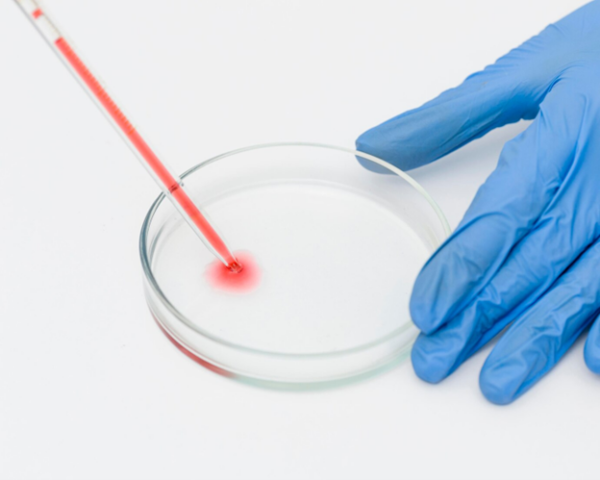 Coombs Test: A Key to Diagnosing Blood Disorders and Ensuring Your ...