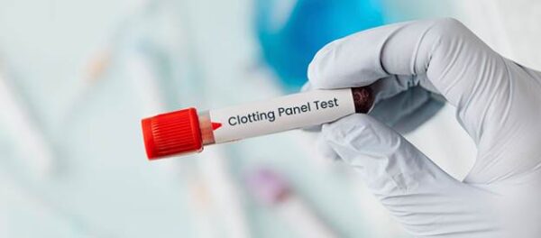 Understanding Coagulation Profile Tests: What Are They and Why Are They ...