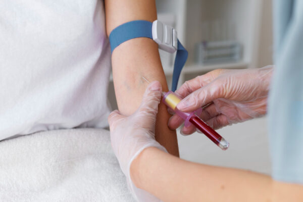 Serum Calcium Test Indications: What You Need to Know - Elite Diagnostics