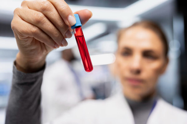 Serum Testosterone Level: Understanding Its Importance, Normal Ranges ...